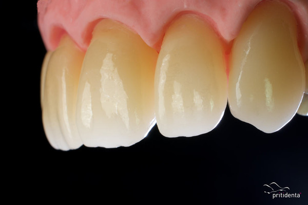 pritidenta ABC - Pritidenta