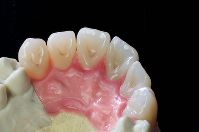 pritidenta ABC - Pritidenta